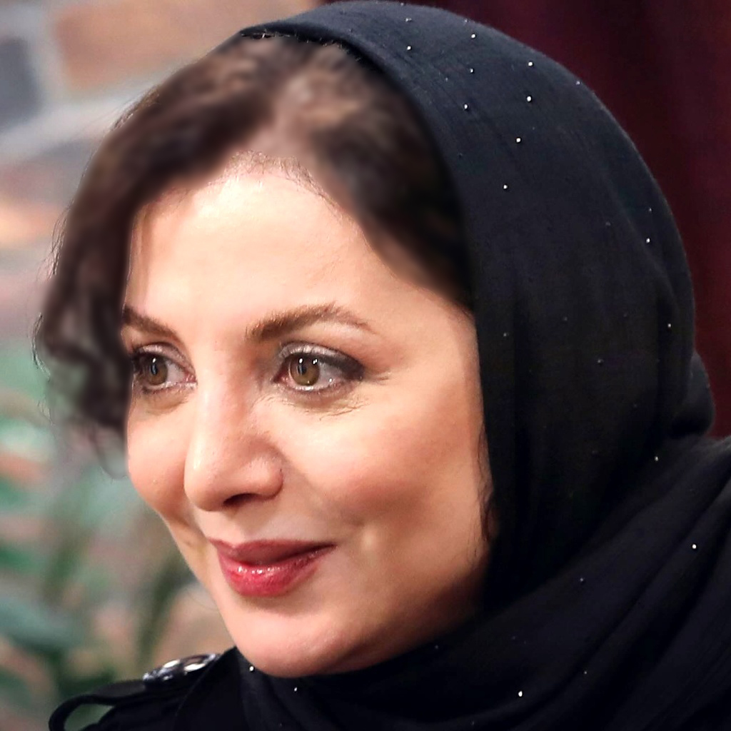 تغییر چهره خانم بازیگر سریال لیسانسه ها بعد 8 سال رویا میرعلمی چقدر