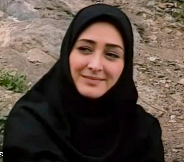 چهره مصنوعی الهام حمیدی بعد از عجیب ترین عمل زیبایی جهان عکس های هوش پران