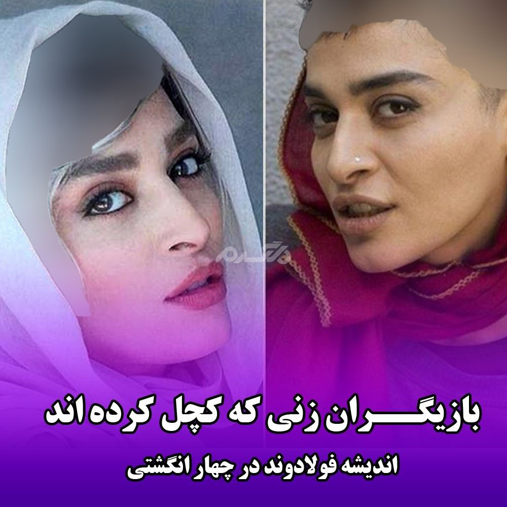 چهره جذاب بازیگران زن با موی تراشیده و سر کچل شیک تر از همیشه عکس ها