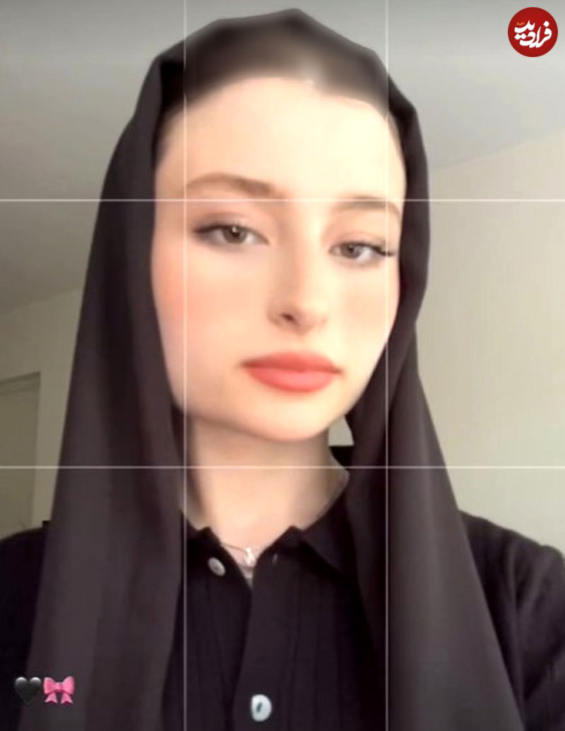 چهره نیکای سریال پایتخت در 20 سالگی پر از ژل و تزریق
